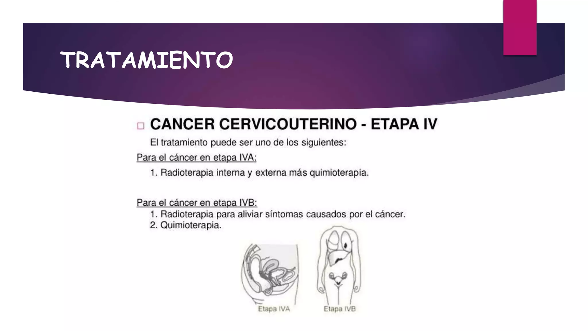 Cancer de-cervix | PPTX
