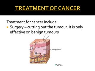 Cancer grade 10 | PPTX
