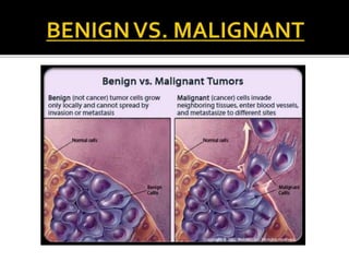 Cancer grade 10 | PPTX