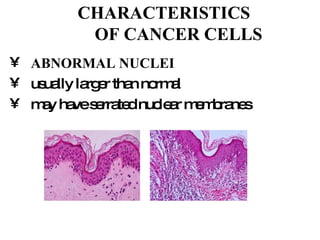 Cancer notes | PPT