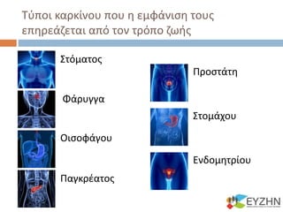 ΠΡΟΛΗΨΗ ΚΑΡΚΙΝΟΥ | PPT