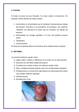 Cancer al aparato reproductor masculino | DOCX