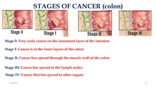 Cancer and antineoplastic agents gbk | PPTX