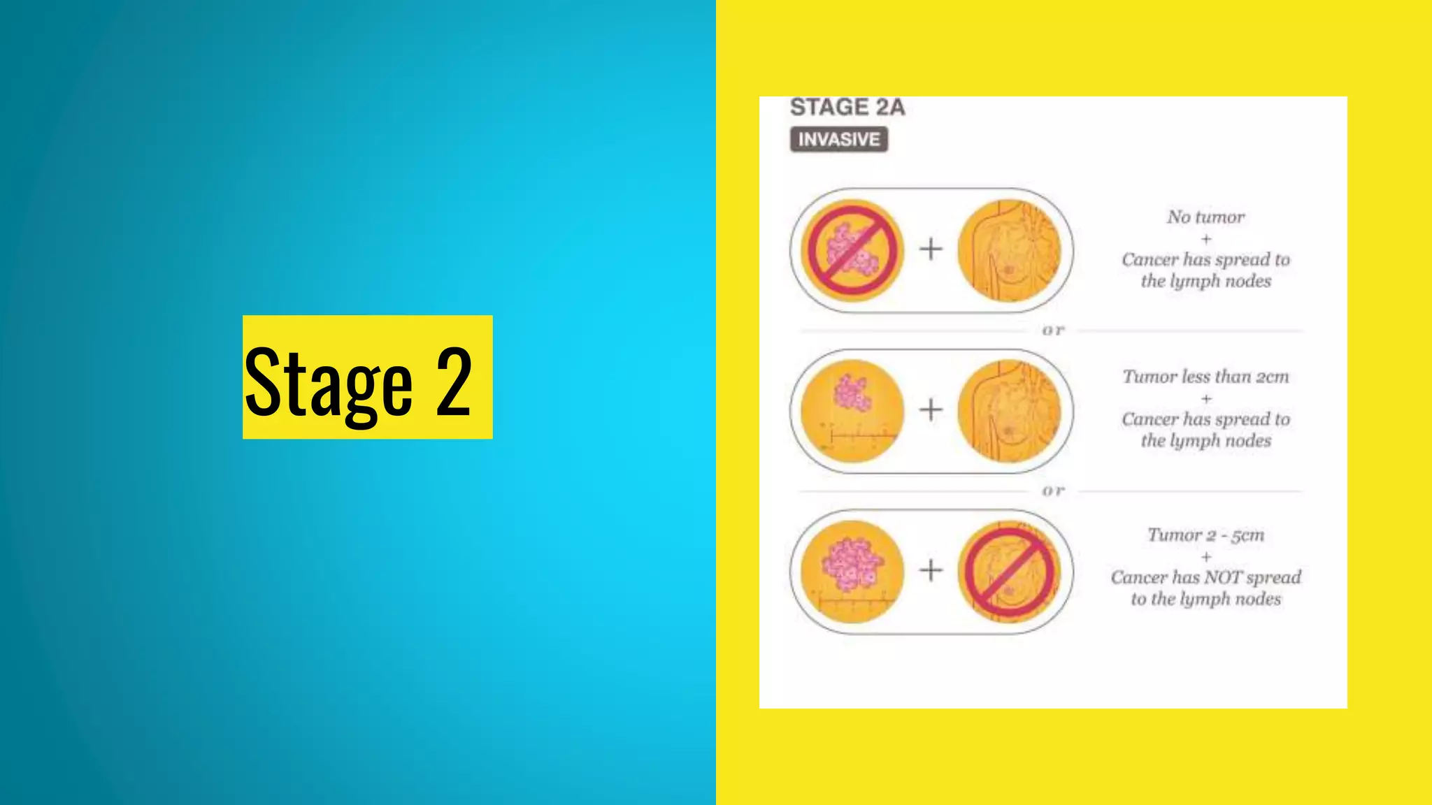 CANCER AND TYPES AND STAGES.pptx