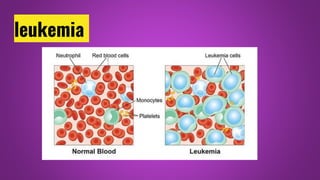 CANCER AND TYPES AND STAGES.pptx