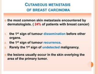 cutaneous metastasis of breast cancer | PPTX