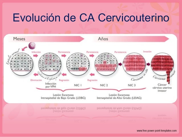 Cancer cervicouterino CACU