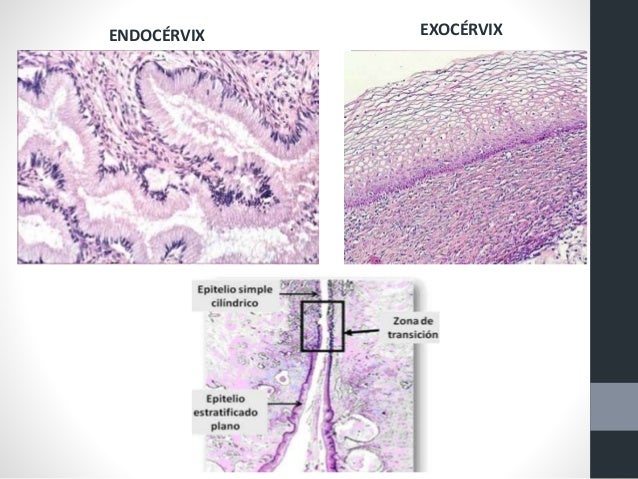 Endocervix Y Exocervix Organos Genitales Femeninos
