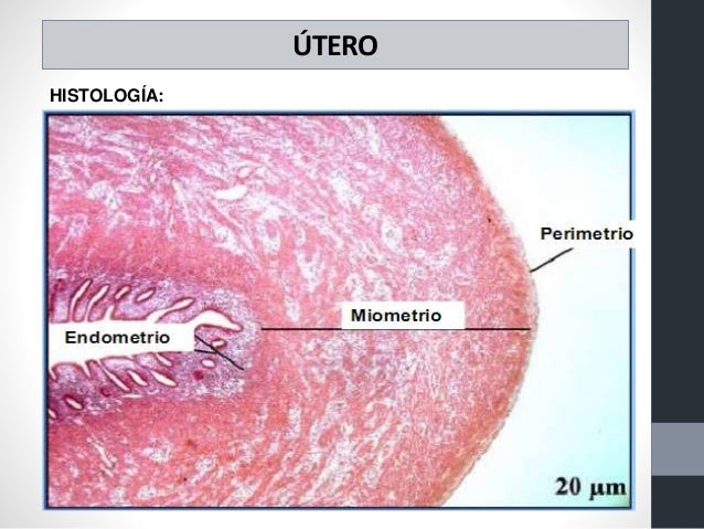 Cancer cervico uterino