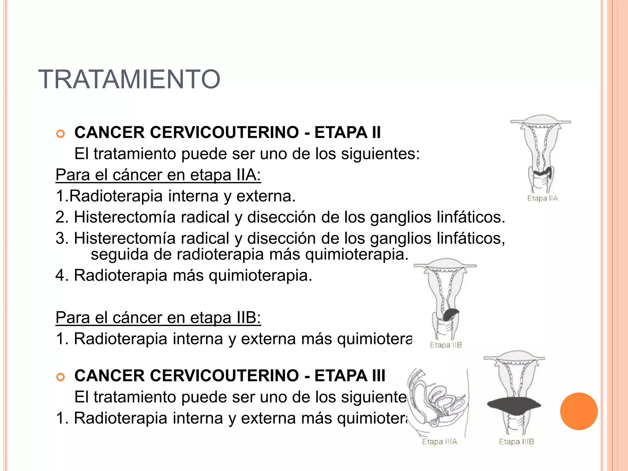 Cancer cervicouterino | PPTX