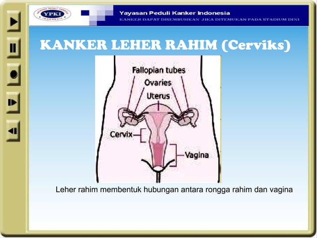 Cancer cerviks | PPT