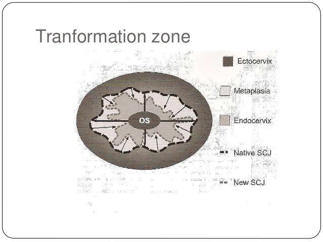 Cancer cervix screening