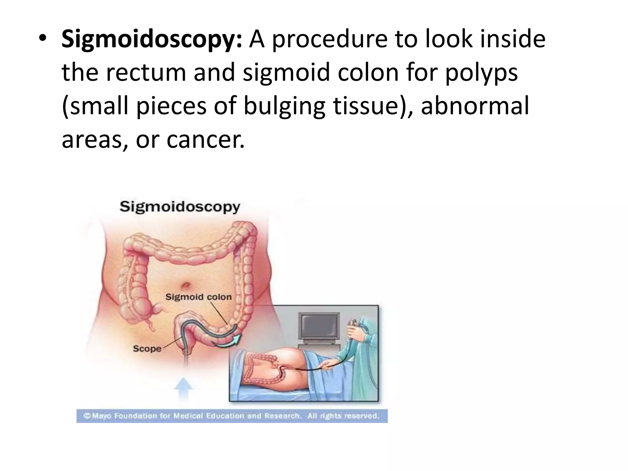 Cancer colon | PPTX