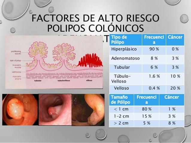 CANCER COLORECTAL Prevención, Diagnóstico y Tratamiento