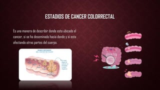 Cáncer colorrectal | PDF