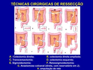 Cancer colorretal 18022013 | PPT