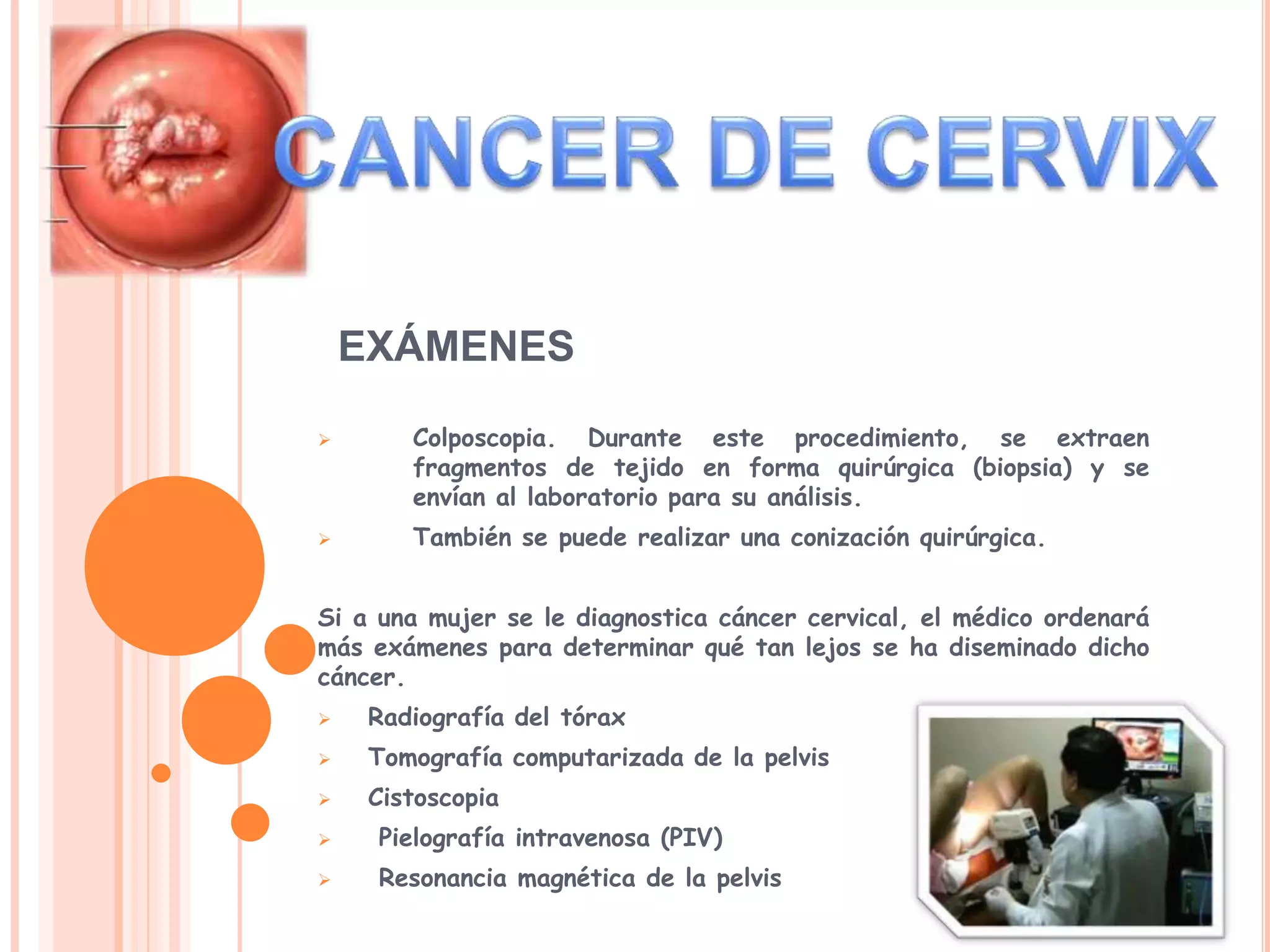 Cancer de cervix | PPTX | Reproductive Health | Diseases and Conditions