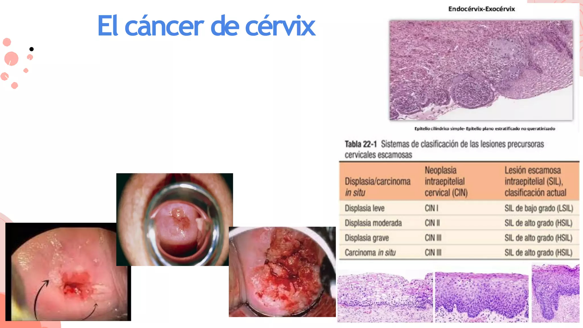 CANCER DE CERVIX.pdf