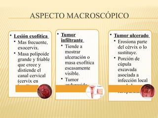 cancer de cervix diagnostico y tratamiento onco.pptx