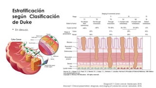 Cáncer de colon | PPTX