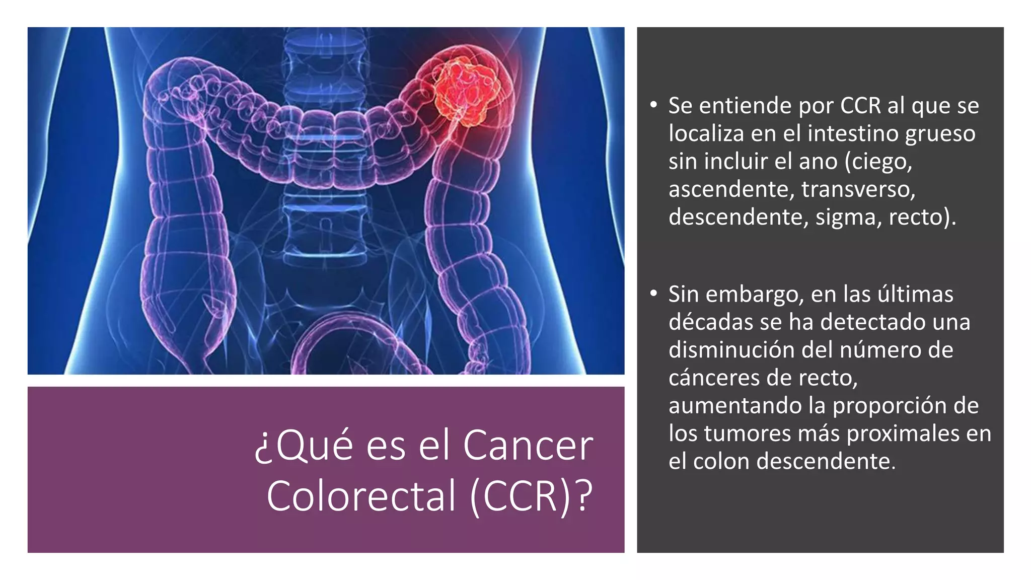 Cancer de colon | PPTX