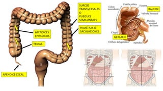 cancer de colon.pptx