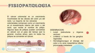 CANCER DE COLON.pdf diapositivas medicina | PDF
