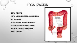 Cancer de colon 2 | PPTX