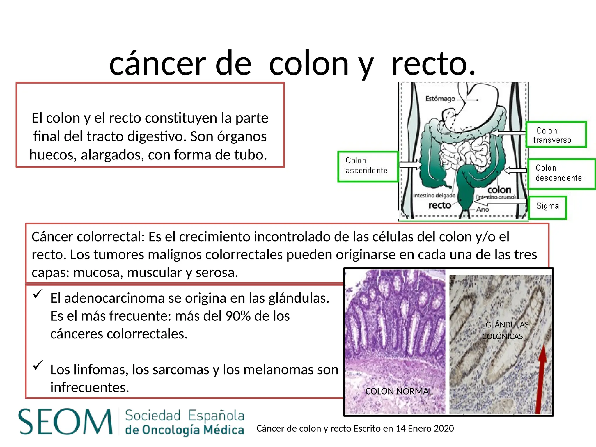CANCER DE COLON Y RECTO Causas y factores de Riesgo | PPTX