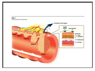 CANCER DE COLON Y RECTO Causas y factores de Riesgo | PPTX