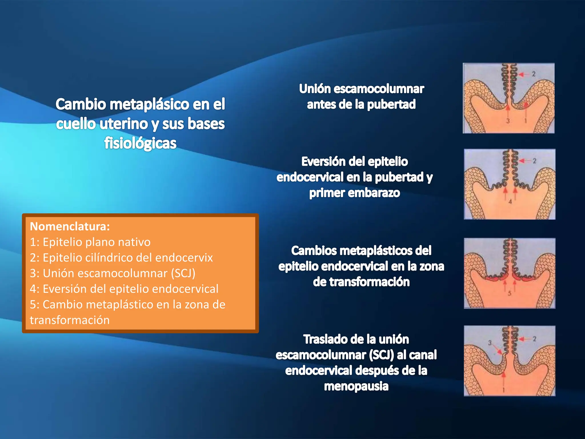 CANCER DE CUELLO UTERINO DIAGNOSTICO Y TRATAMIENTO.pptx