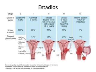 Cancer Uterino Grado 3 _ O que é o estágio 3 do câncer uterino ...