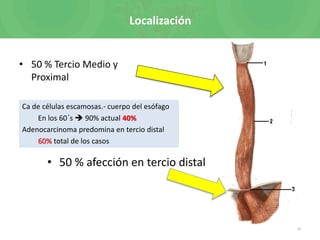 cancer de esofago.pdf
