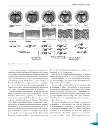 Cancer de laringe | PDF