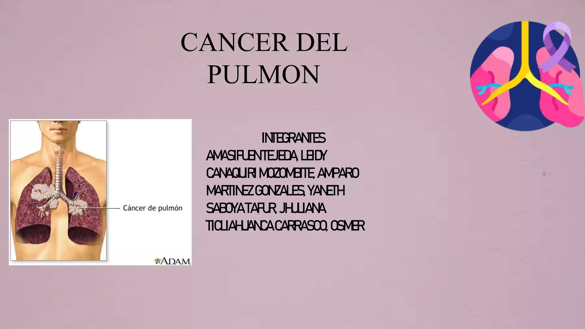 Cáncer del pulmón | PPT