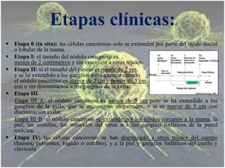 Cancer de mama | PPTX