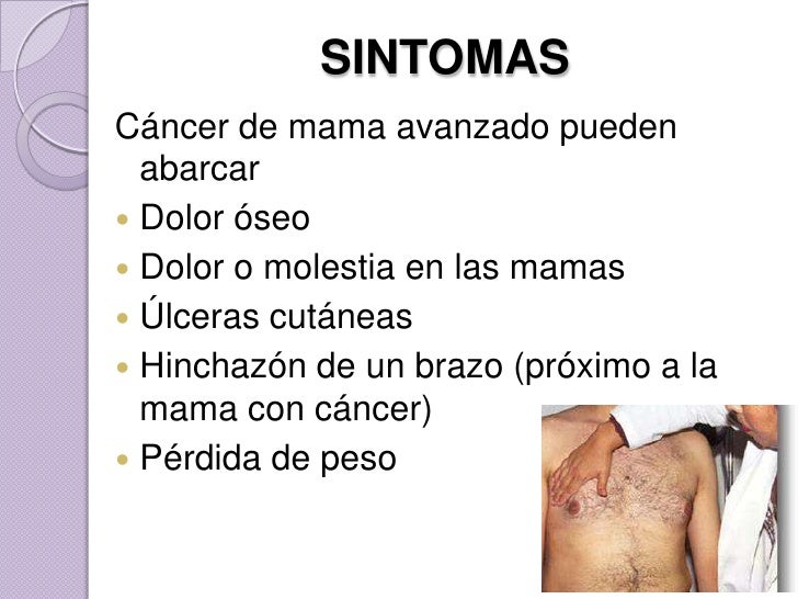 Cancer de mama