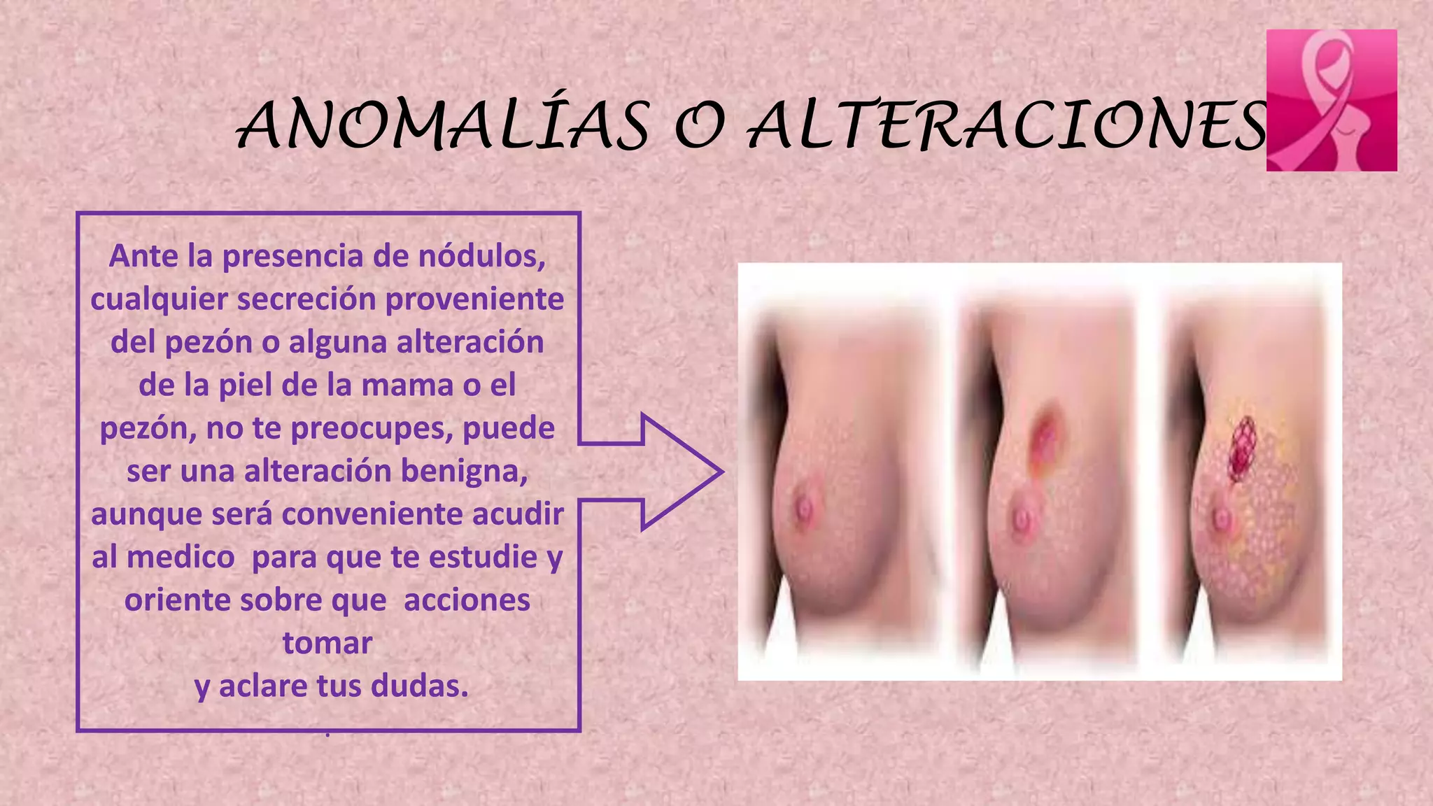 Cancer De Mama Ppt