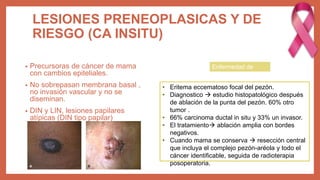 Cancer de mama | PPTX