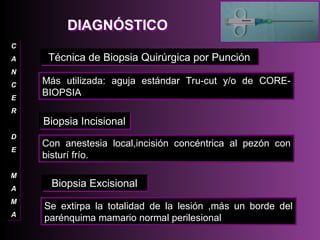 cancer de mama.ppt que es referencia de las patologías de mama | PPT