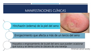 Cancer de mama en hombres | PPTX
