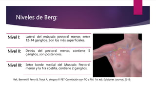 cancer de mama final.pptx