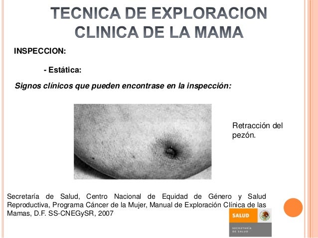 Cancer De Mama Imagenología