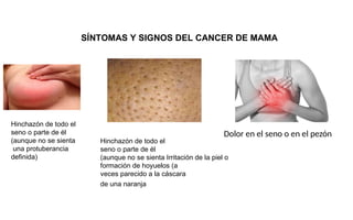 cancer de mama petrocasa.p mes rosa diaptx | PPTX