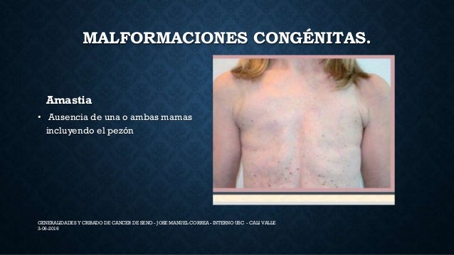 ANATOMIA, EMBRIOLOGIA - Cancer de mama Y SU CRIBADO