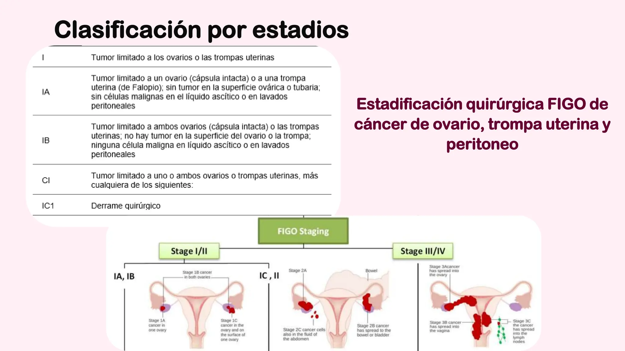 Cancer de Ovario 2024 epidemiologia importancia fsiopatologia | PPTX ...
