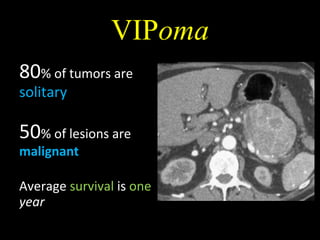 Pancreatic Neoplasms | PPT