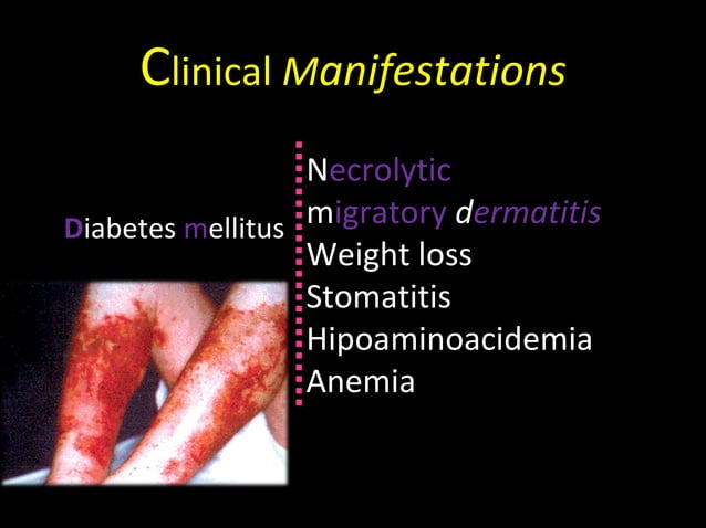 Pancreatic Neoplasms | PPT