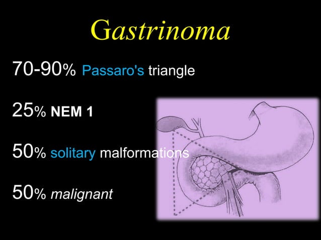 Pancreatic Neoplasms | PPT