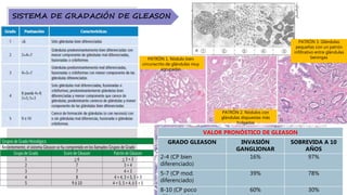 Cancer de próstata | PPTX